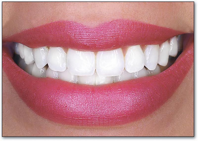 Avea tartru pe dinți și nu voia să mai dea banii medicului stomatolog ...