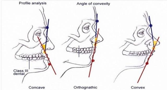 Tu ce profil al feţei ai? Consultă imaginea şi vezi ce spune despre ...