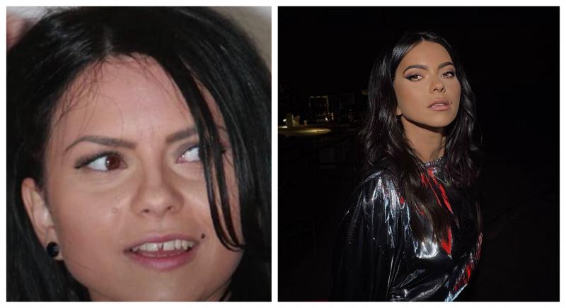 Inna a spus tot adevărul despre operațiile estetice! Ce modificări și-a ...